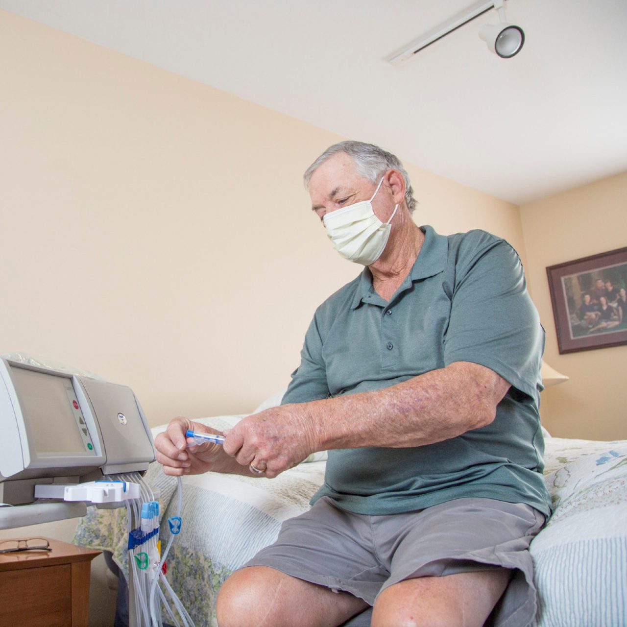 Peritonealdialyse (Bauchfelldialyse) - DaVita